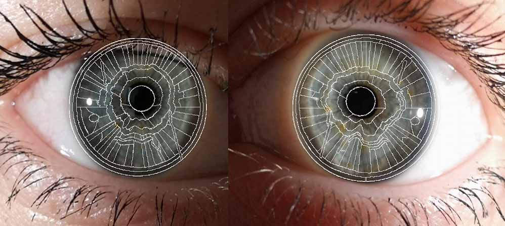 Registered Iridologist Diploma - R.Irid - Iridology International
